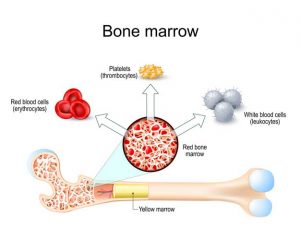 Bone Marrow Biopsy - Information Guide